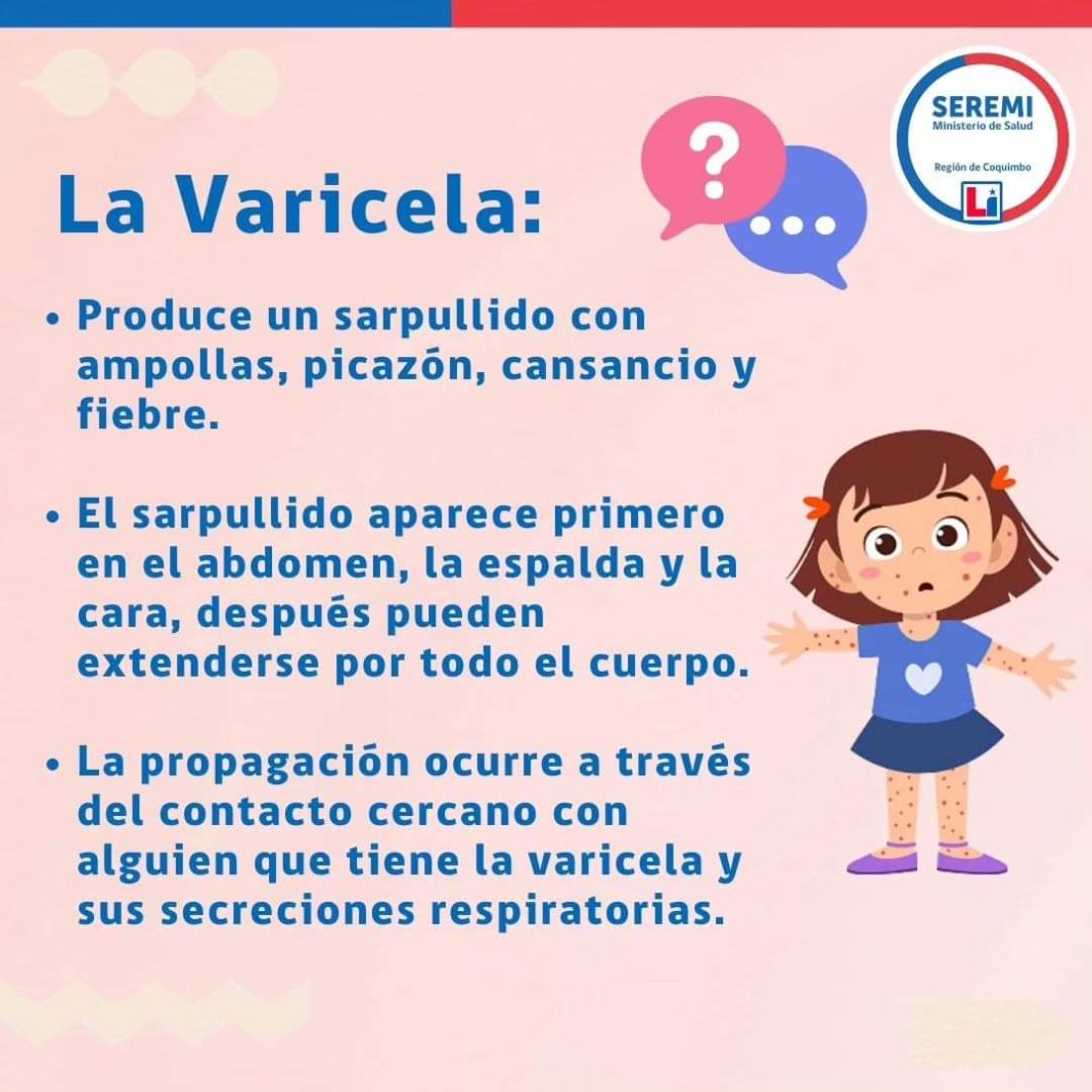 Información Varicela – Francis School